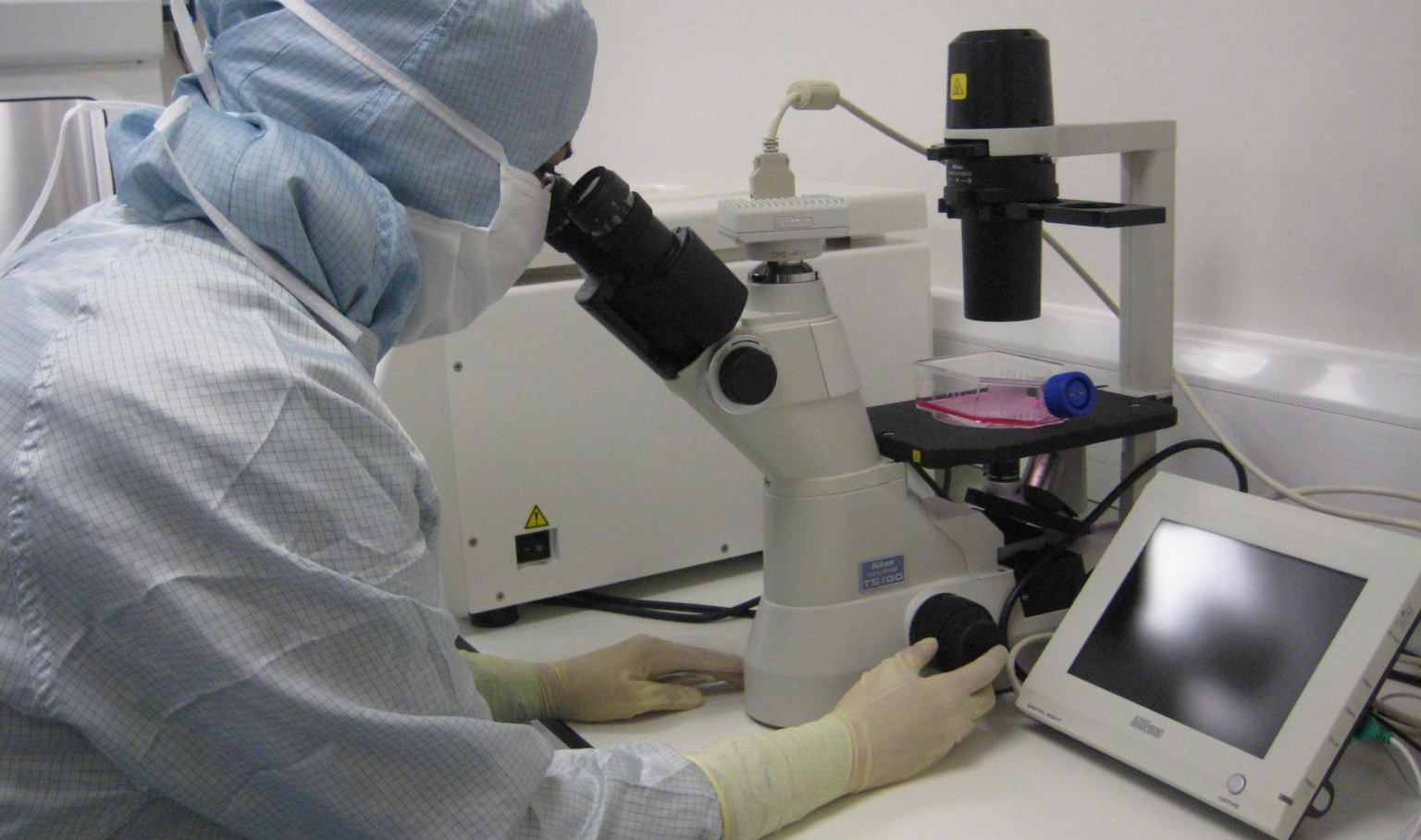 UCL research is the foundation for seminal breakthrough in Alzheimer’s ...